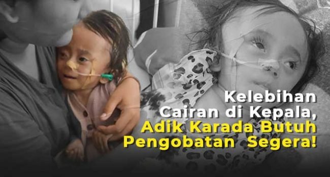 Campaign - Urgent! Bantu Karada Berjuang Melawan Hidrosefalus | Aksi Zakat